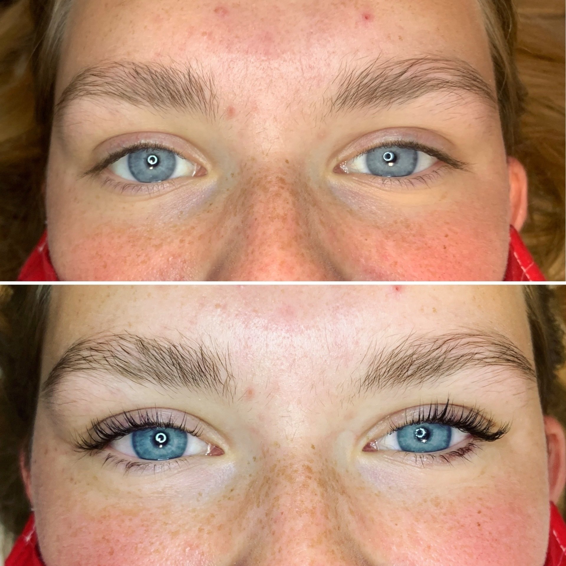 MedSpa Before & After Gallery | MedSpa Treatments Photo Gallery ...