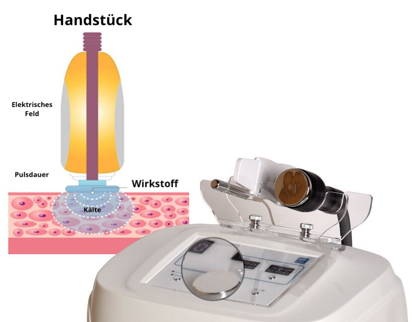 CRYO INFUSION Anti-Aging | Parker Medical Beauty GmbH