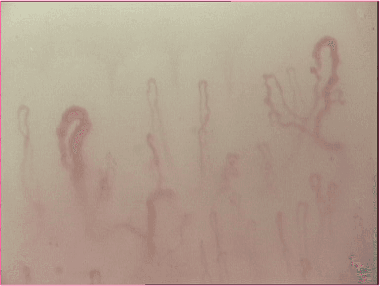 Capillaroscopia - Torino e Pinerolo - Dottor Roberto Carapellucci