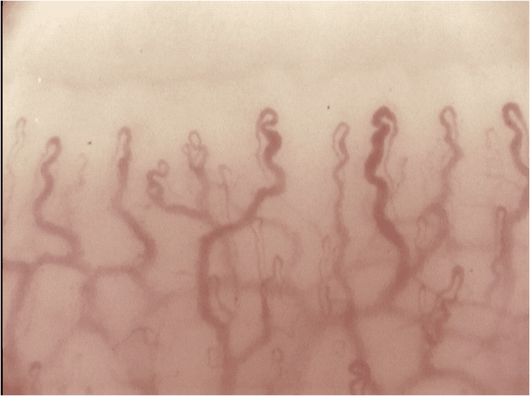 Capillaroscopia - Torino e Pinerolo - Dottor Roberto Carapellucci