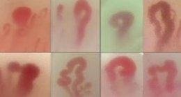 Capillaroscopia - Torino e Pinerolo - Dottor Roberto Carapellucci