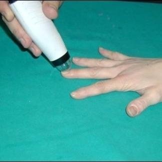 Capillaroscopia - Torino e Pinerolo - Dottor Roberto Carapellucci