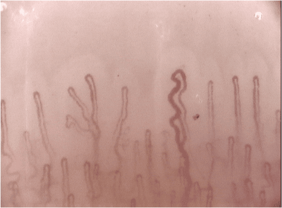 Capillaroscopia - Torino e Pinerolo - Dottor Roberto Carapellucci