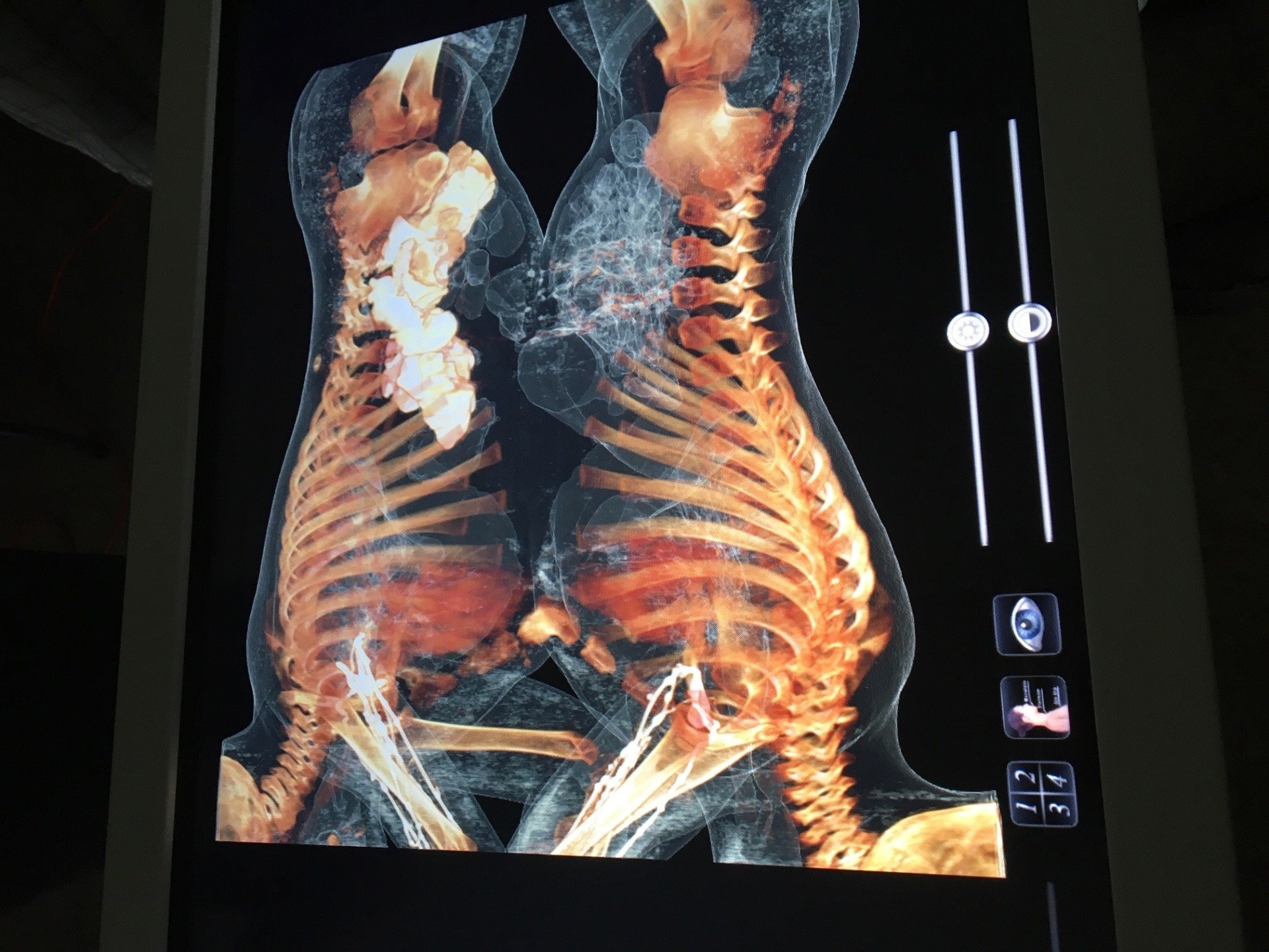 Anatomage Table for Enhanced Biology & Engineering Understanding