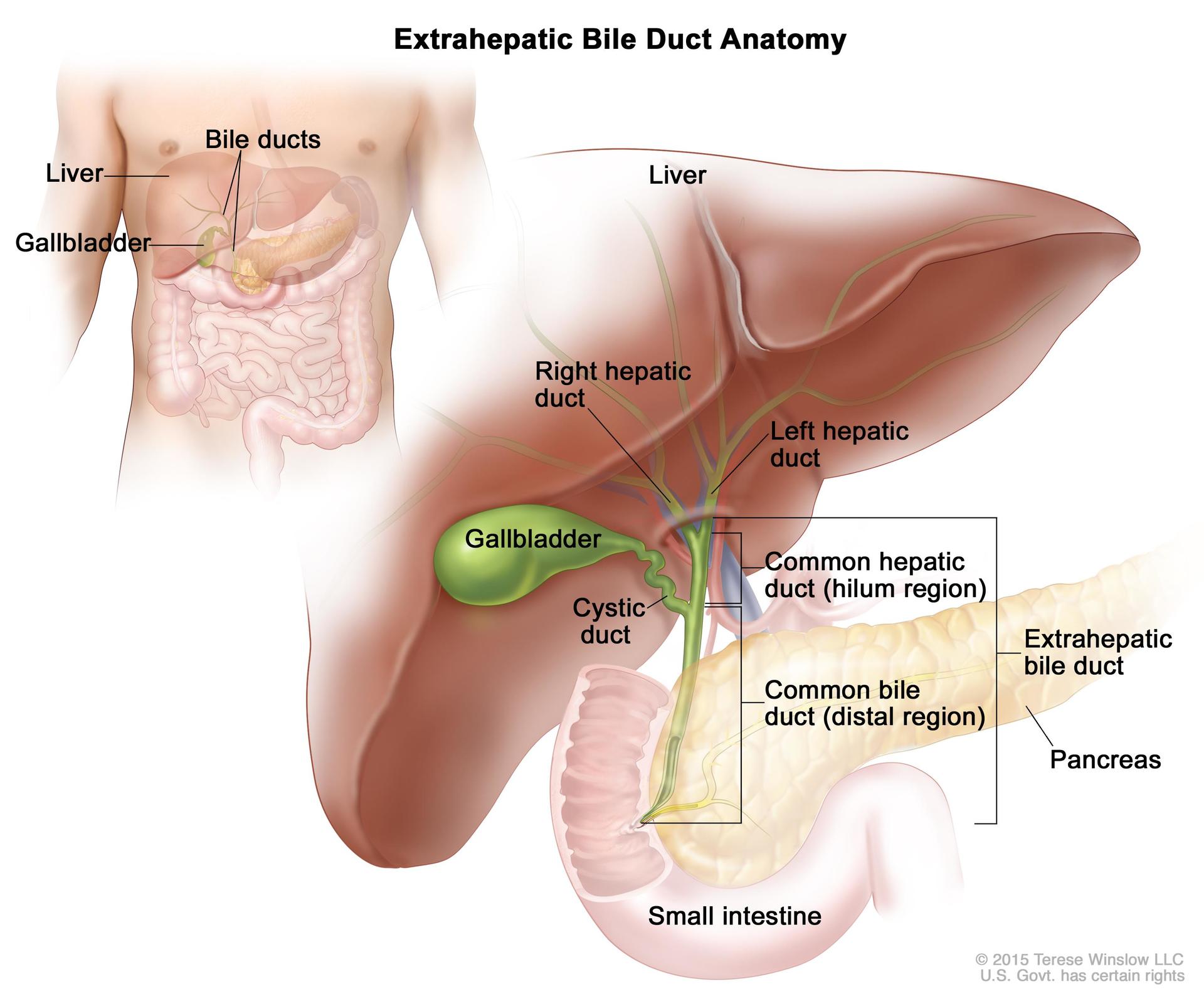 Bile Duct Cancer cholangiocarcinoma 
