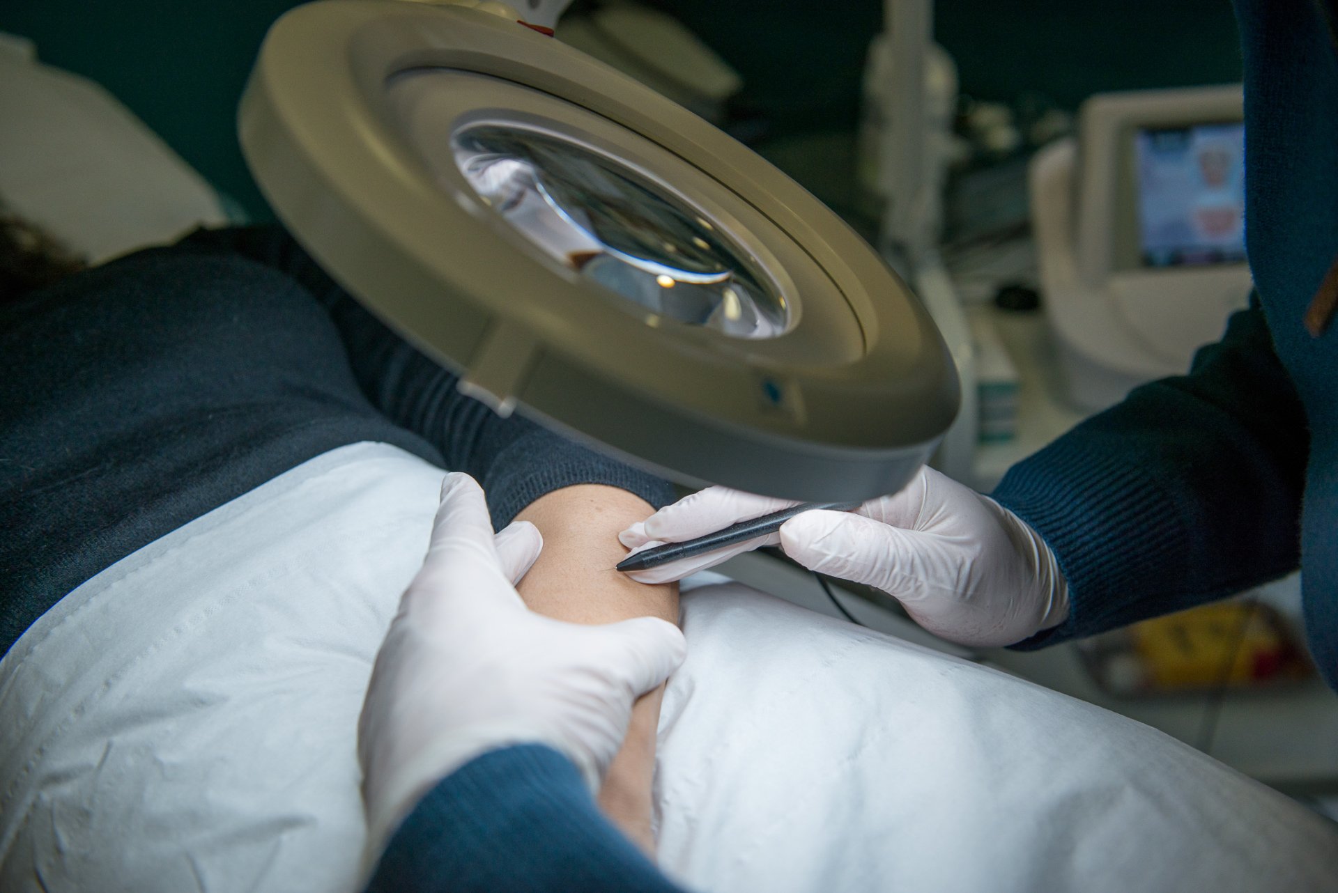 Épilation Électrique | Docteur Sylvain Leullier | Amiens