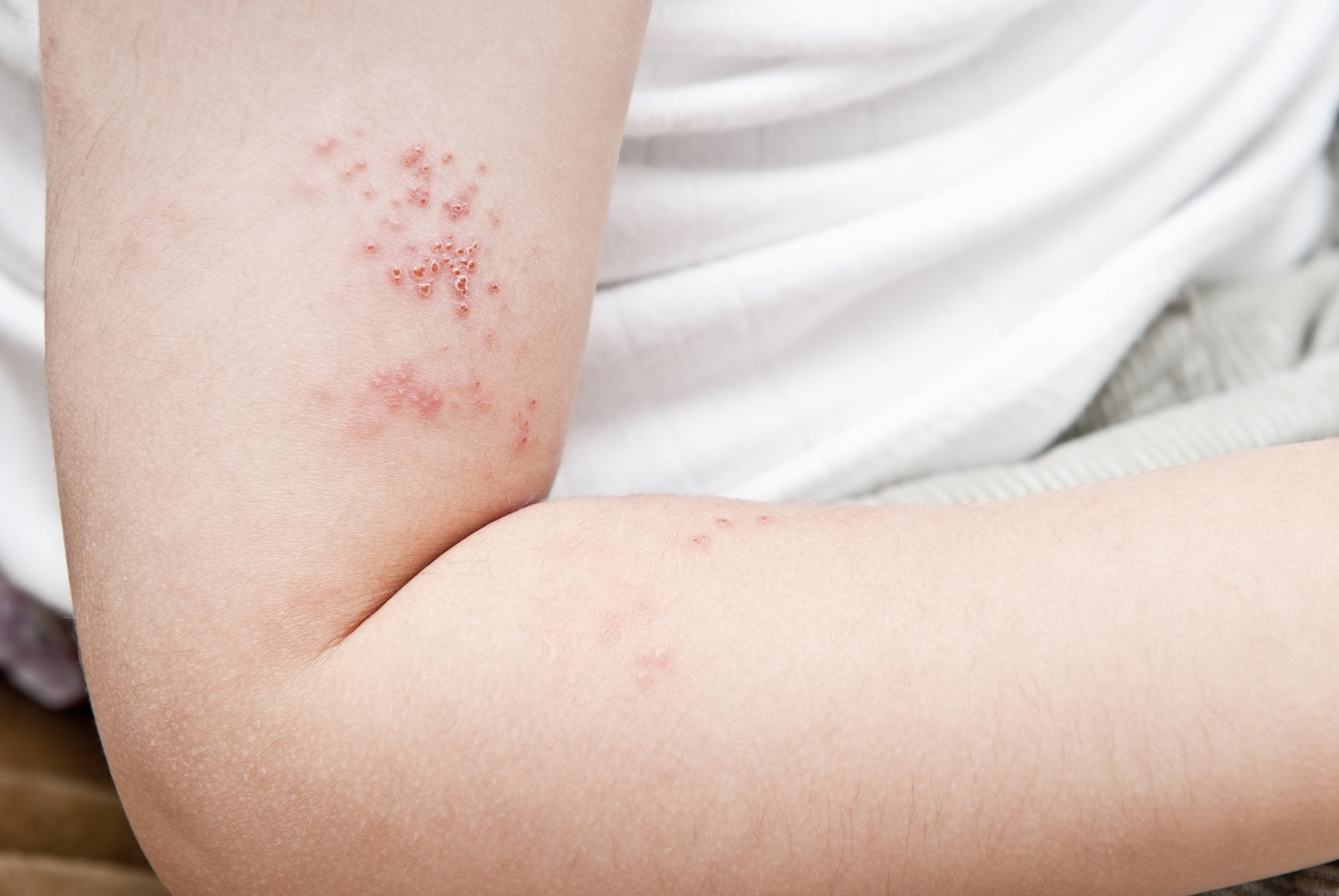 Dermatologists In Clearwater Fl Clear Skin Dermatology
