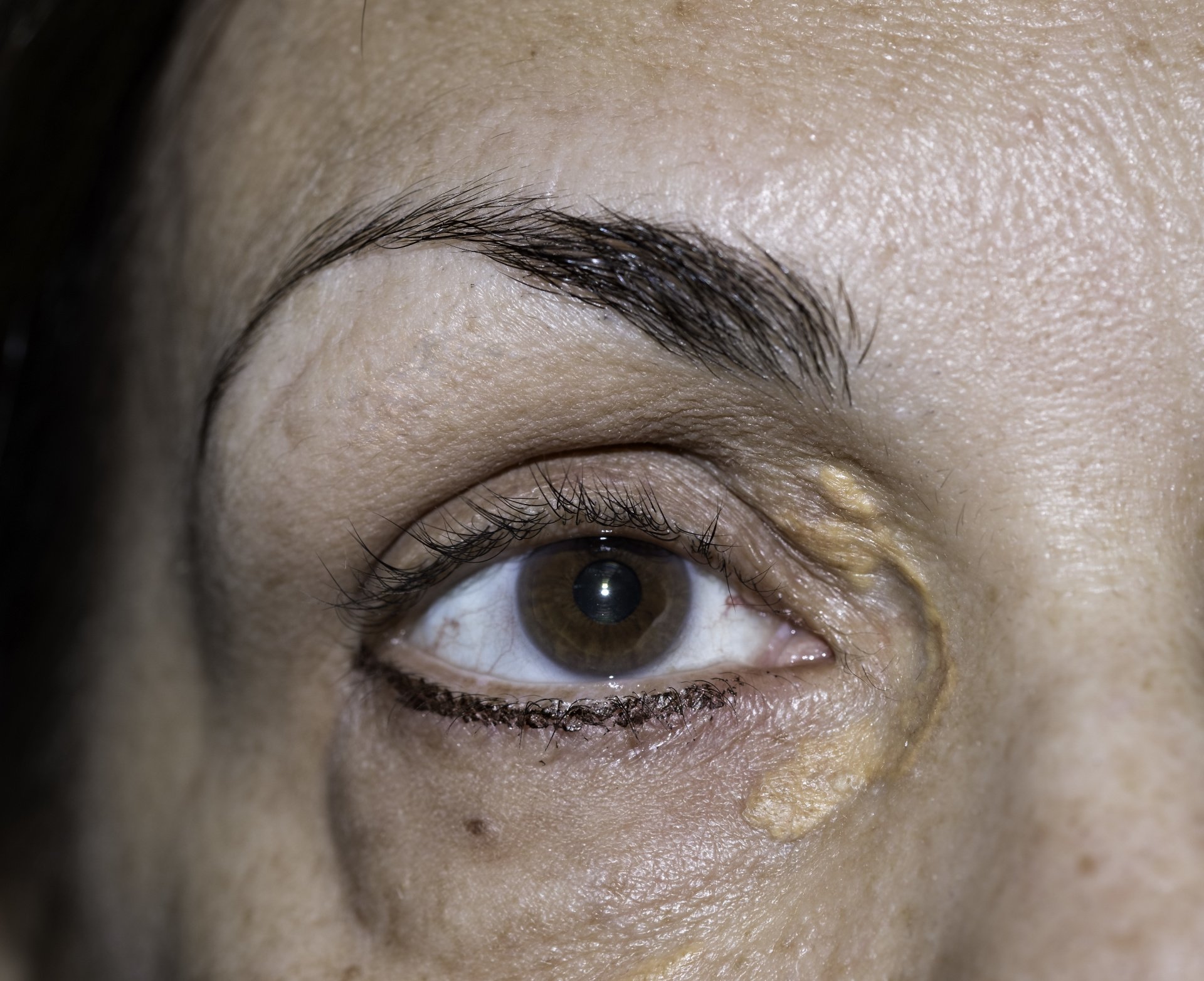 Medecine esthetique par Christian Fayard Le visage médecine ...