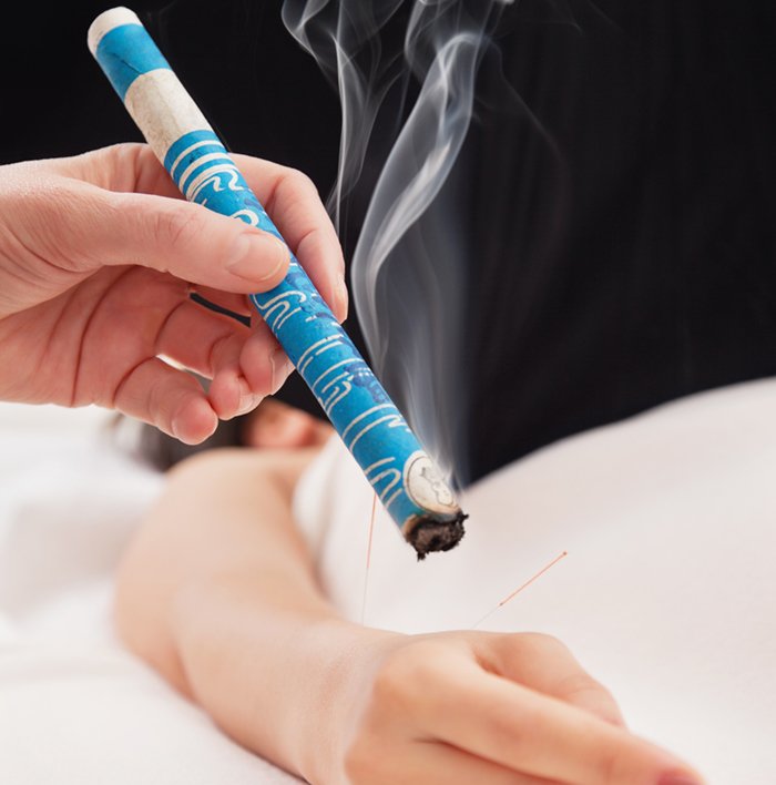 Moxibustion Therapy | A Balanced You Wellness | Jacksonville Florida