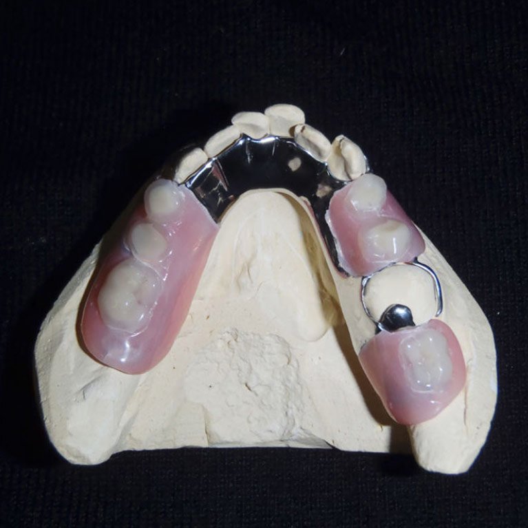 Denture Relines | Frankston | South Frankston Denture Clinic