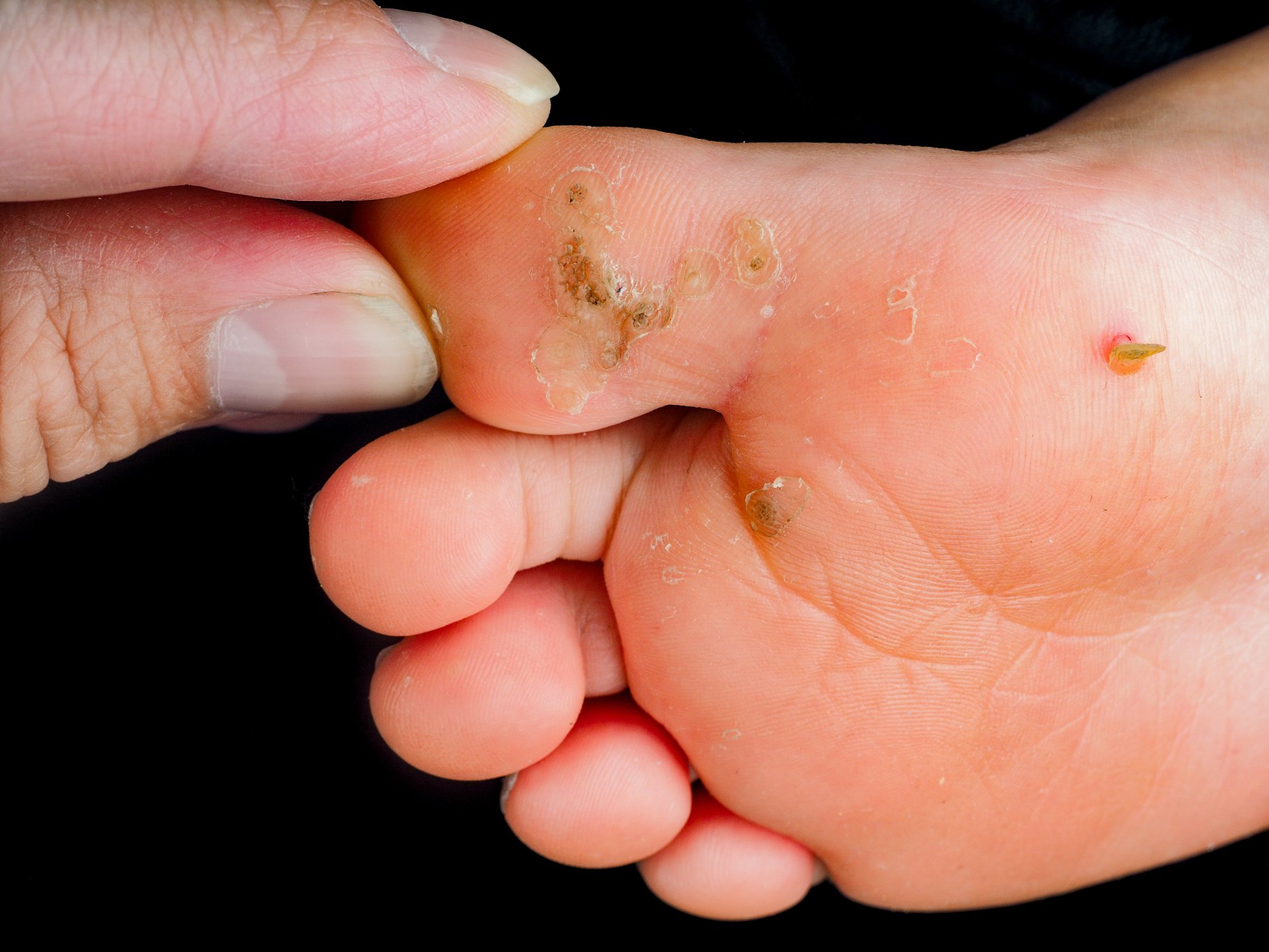 Children's Podiatry & Chiropody | Sally Pembery Associates