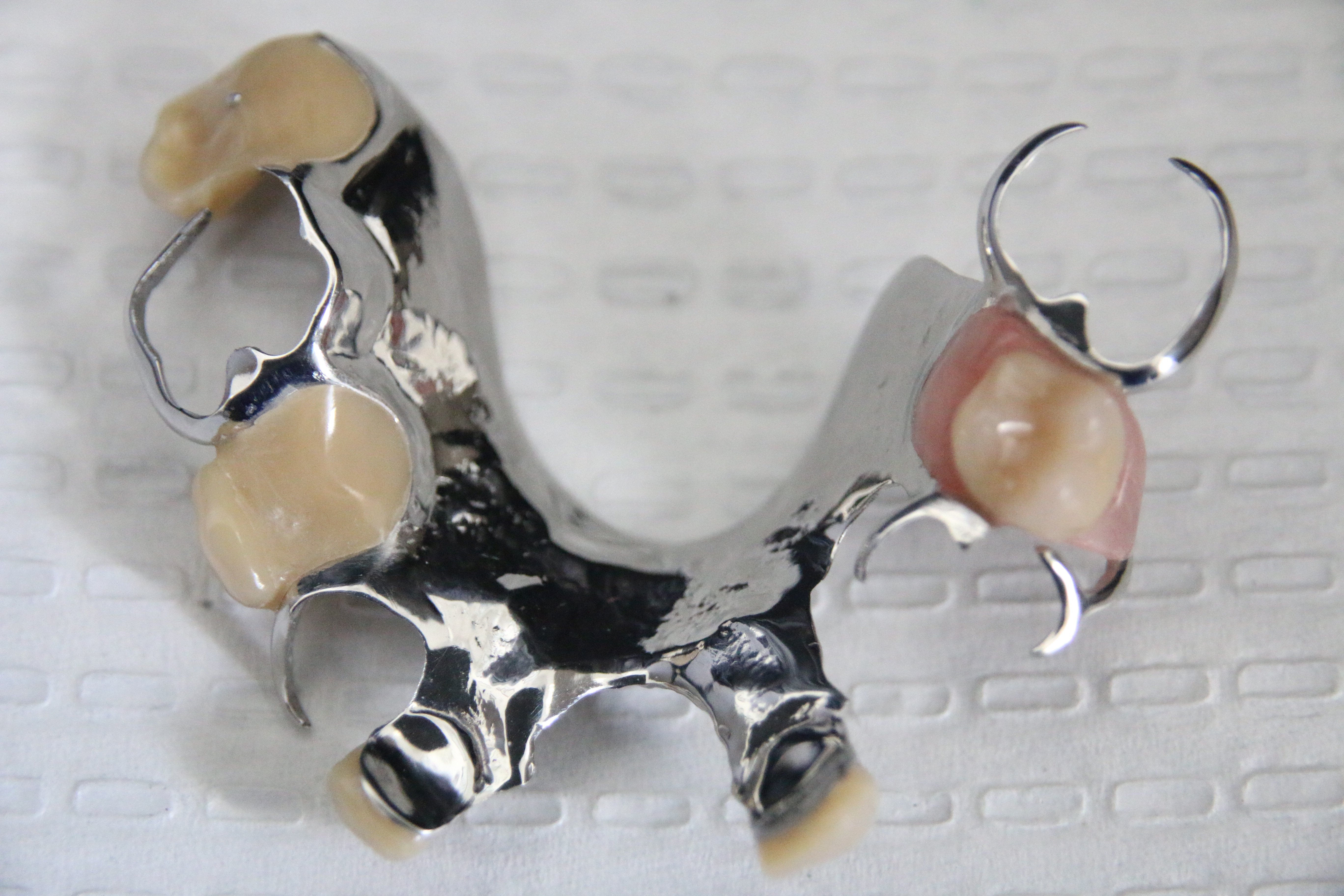 Denture Clinic Gold Coast - Gallery | Denture Doctor