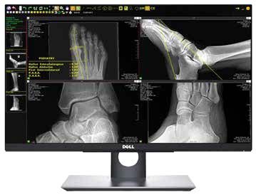 Podiatry Equipment | VXS Imaging