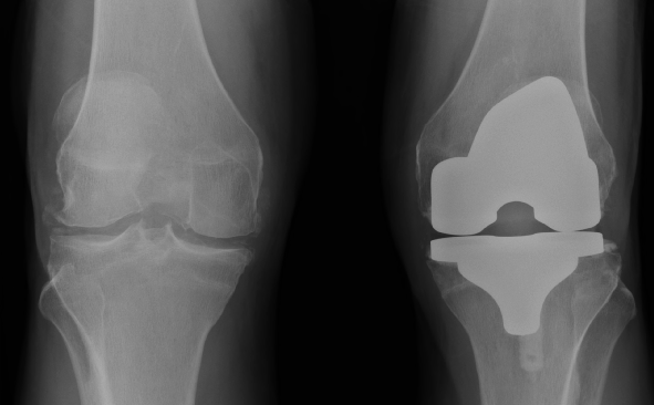 Created for orthopaedic patients by the multdisciplinary team