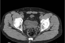 Scanner - Radiologie Daumesnil (Paris 12)