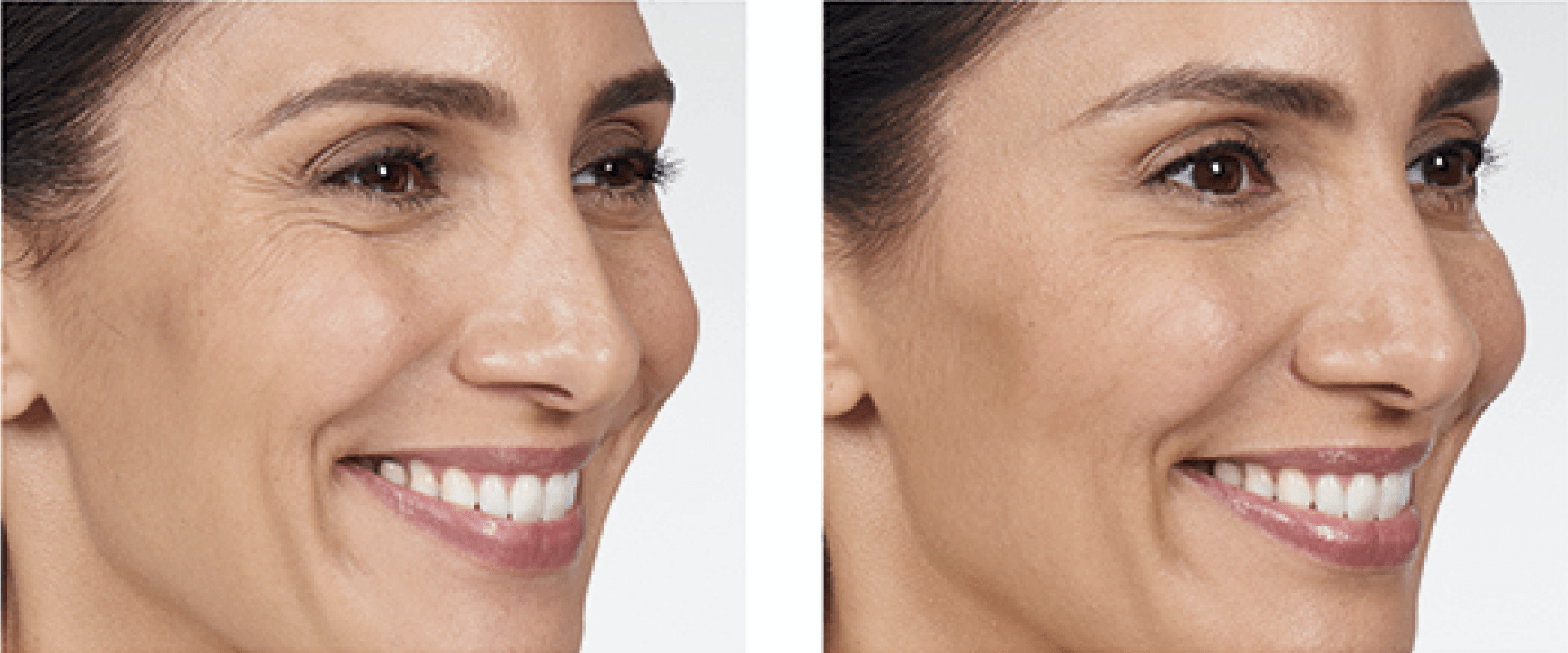 Cosmetic Dermatology in Santa Monica | MedSpa Services