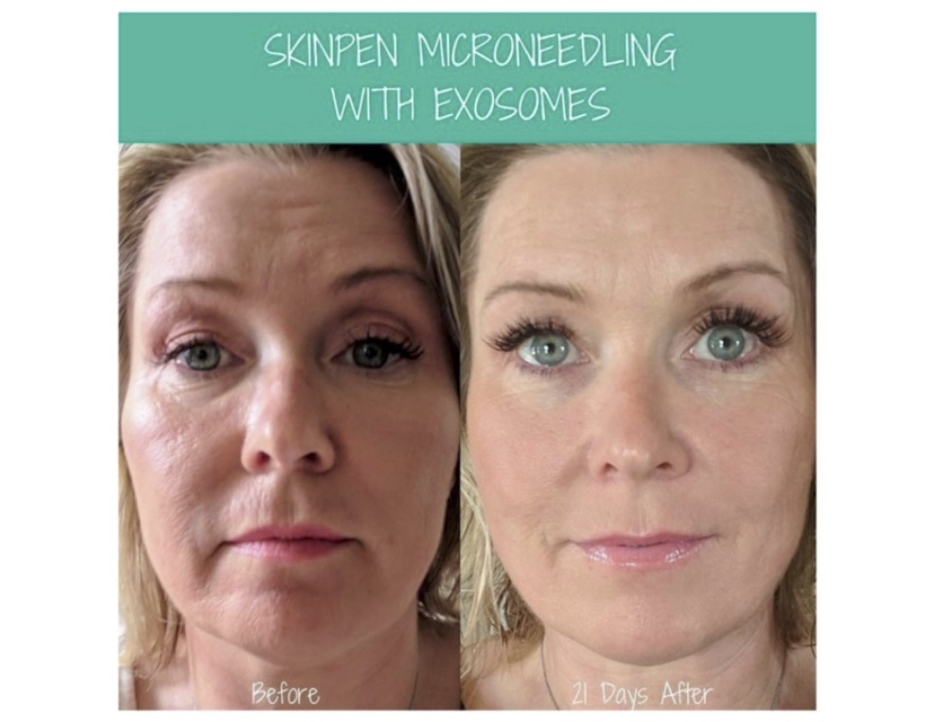 Chicago Laser Skin Rejuvenation Specialist | Dr. Yates Lifestyle Med