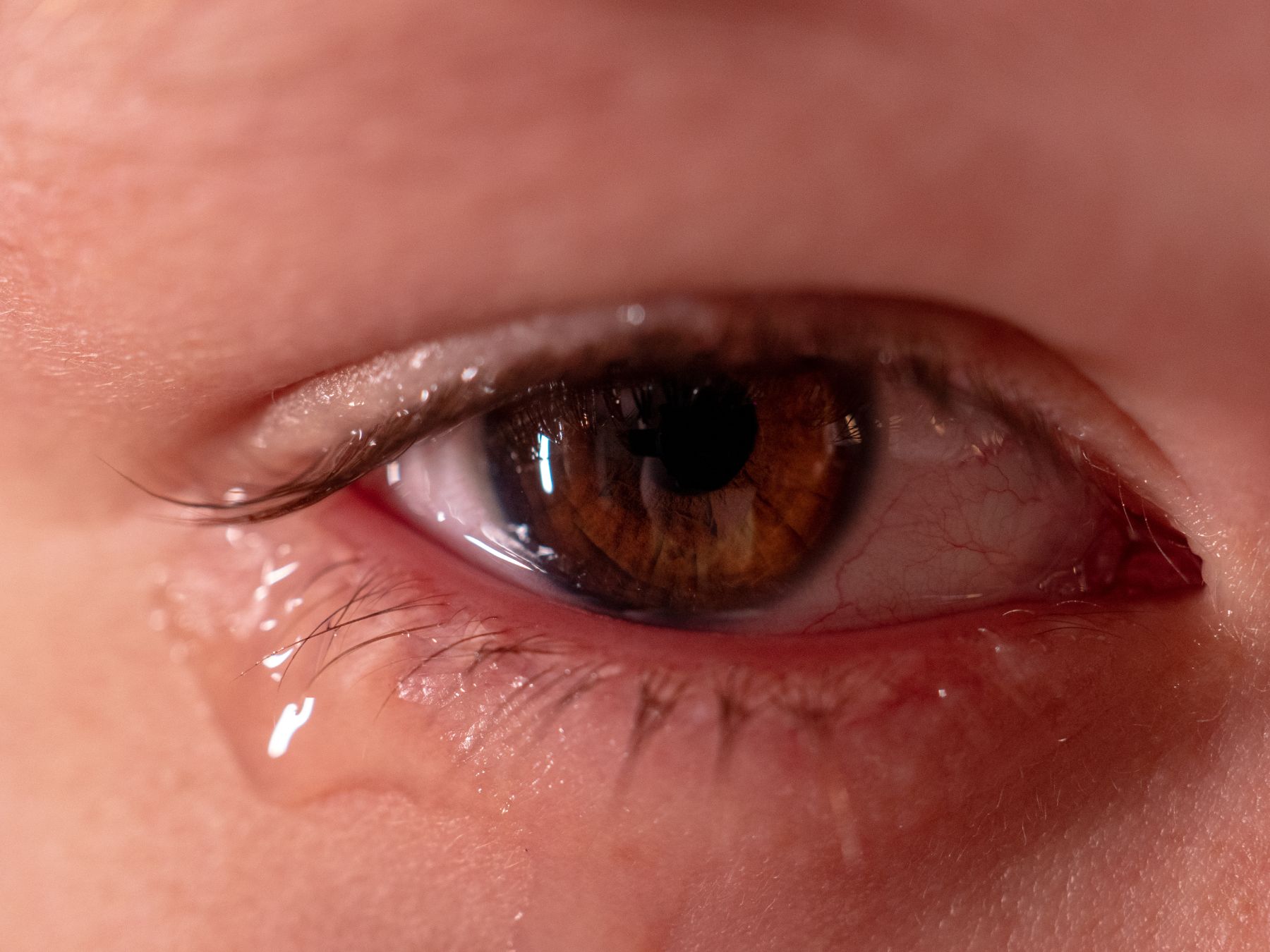 Clarksville Plastic Surgery | Oculoplastic Surgeon Clarksville tn