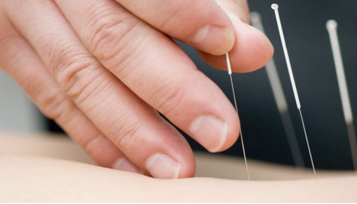 Home [www.thealternativeacupuncture.com]