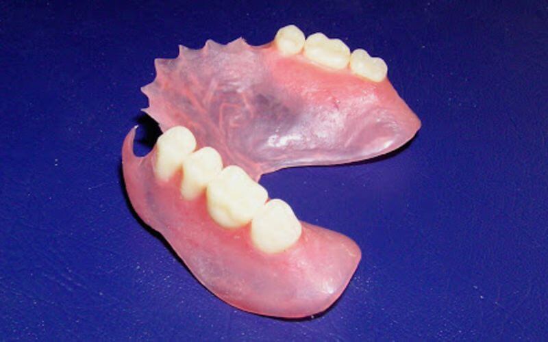 Zobu protezēšana | Stomatoloģijas klīnika Dental Shop