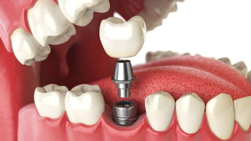 Zobārstniecība un mutes higiēna | Stomatoloģijas klīnika Dental Shop