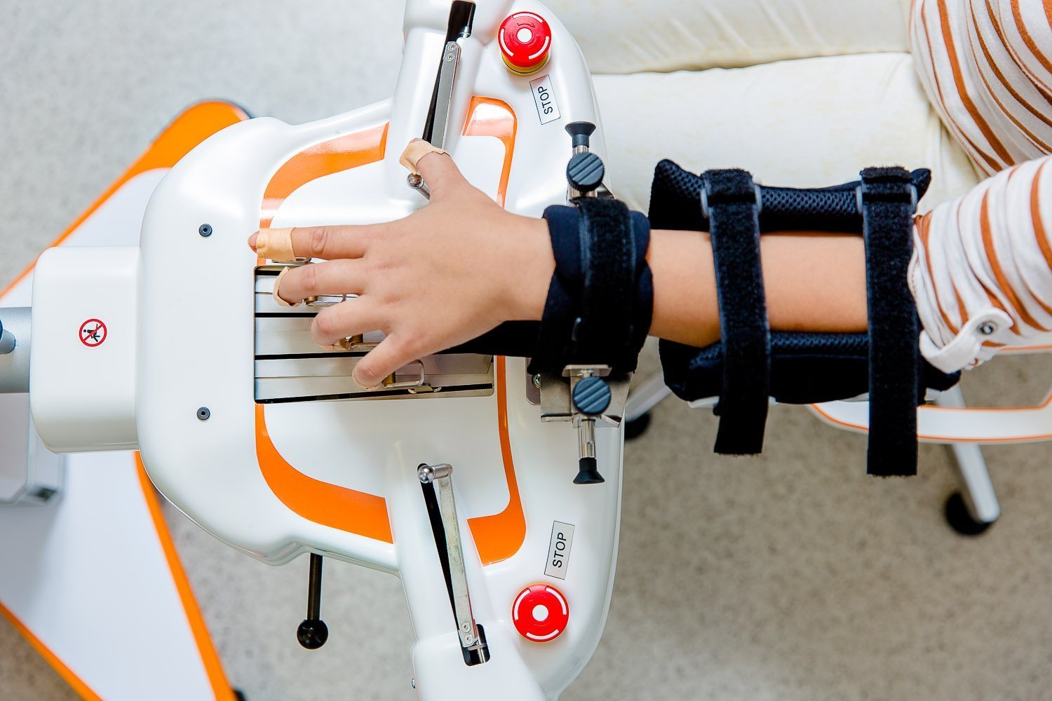 7 Ways the Amadeo Hand Robot Can Aid Stroke Recovery