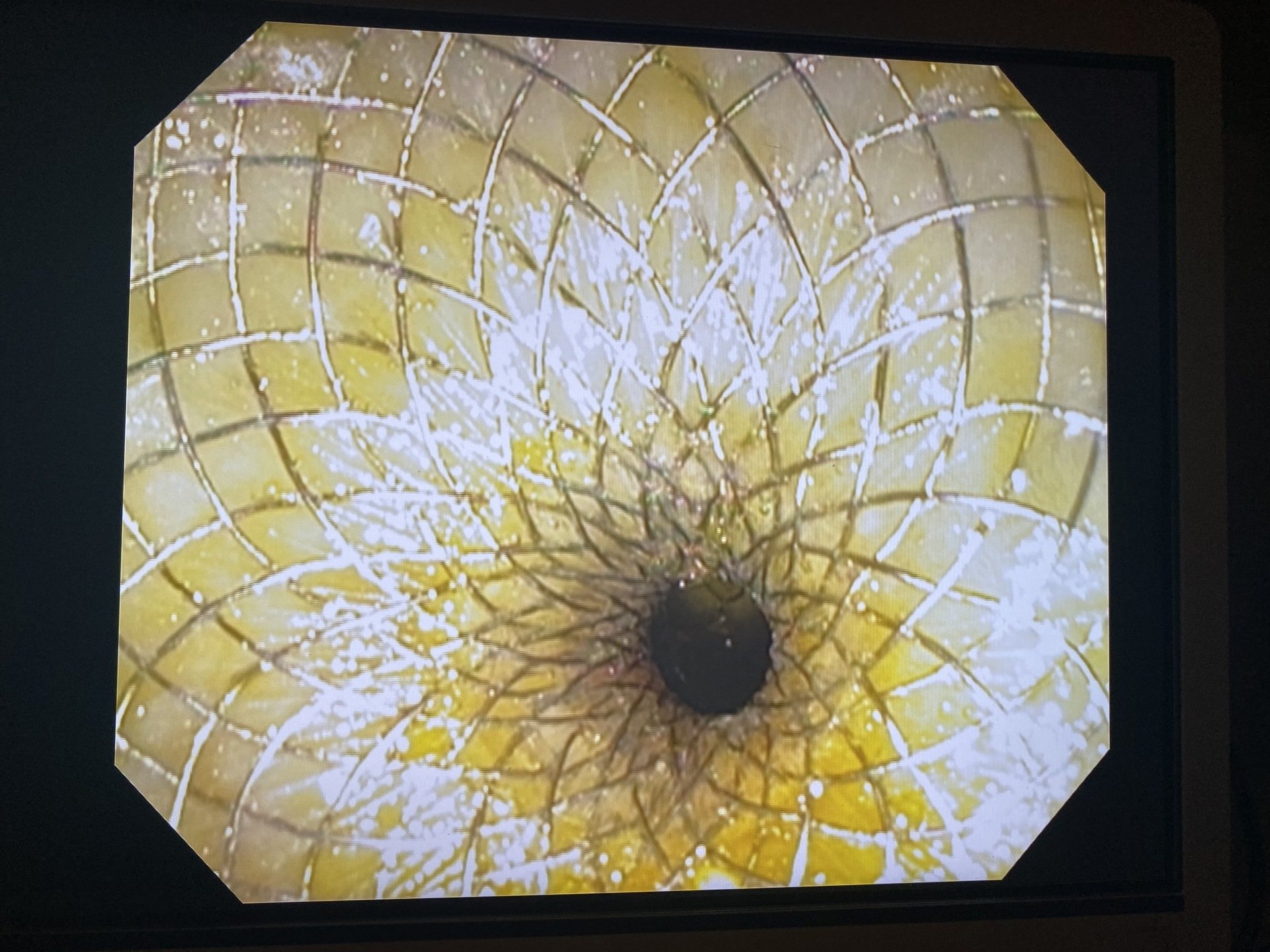 Advanced Endoscopy & Gastroenterology