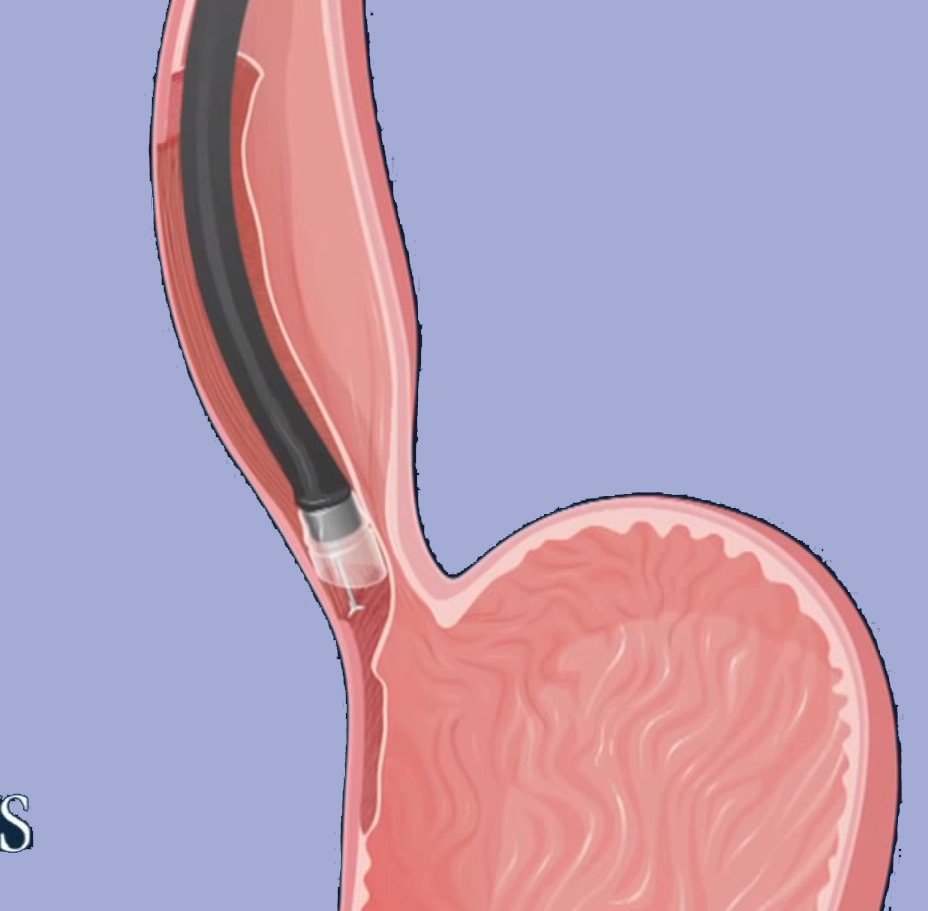 Advanced Endoscopy & Gastroenterology