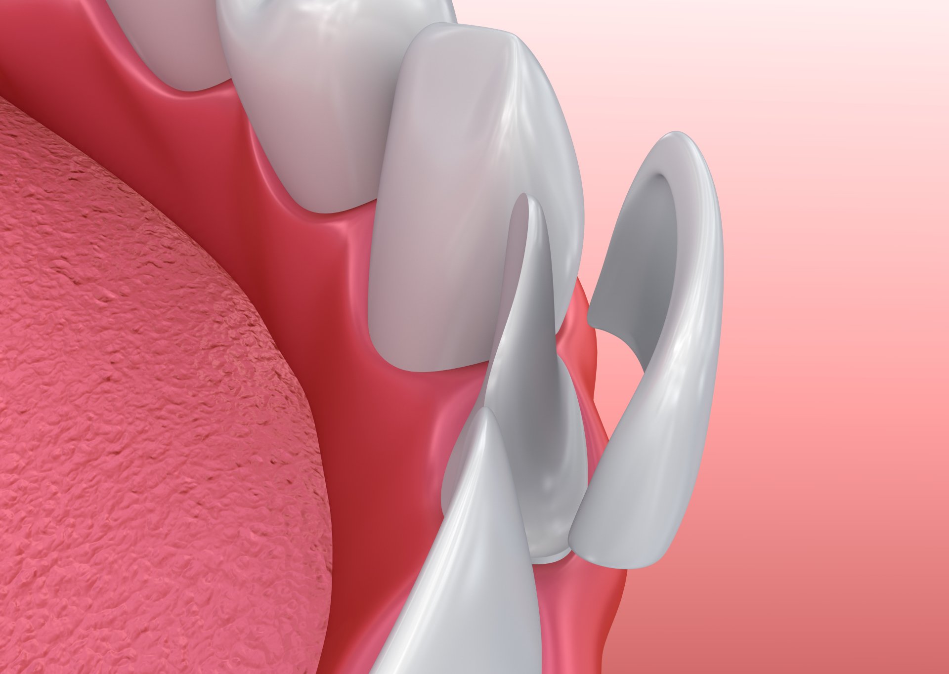 Griesbach Family Dental | North Edmonton Dental Clinic