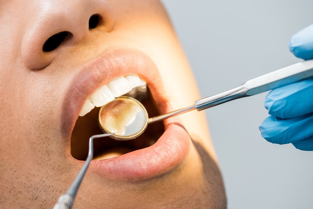 Is Acid Reflux Damaging Your Teeth Is Acid Reflux Damaging Your Teeth
