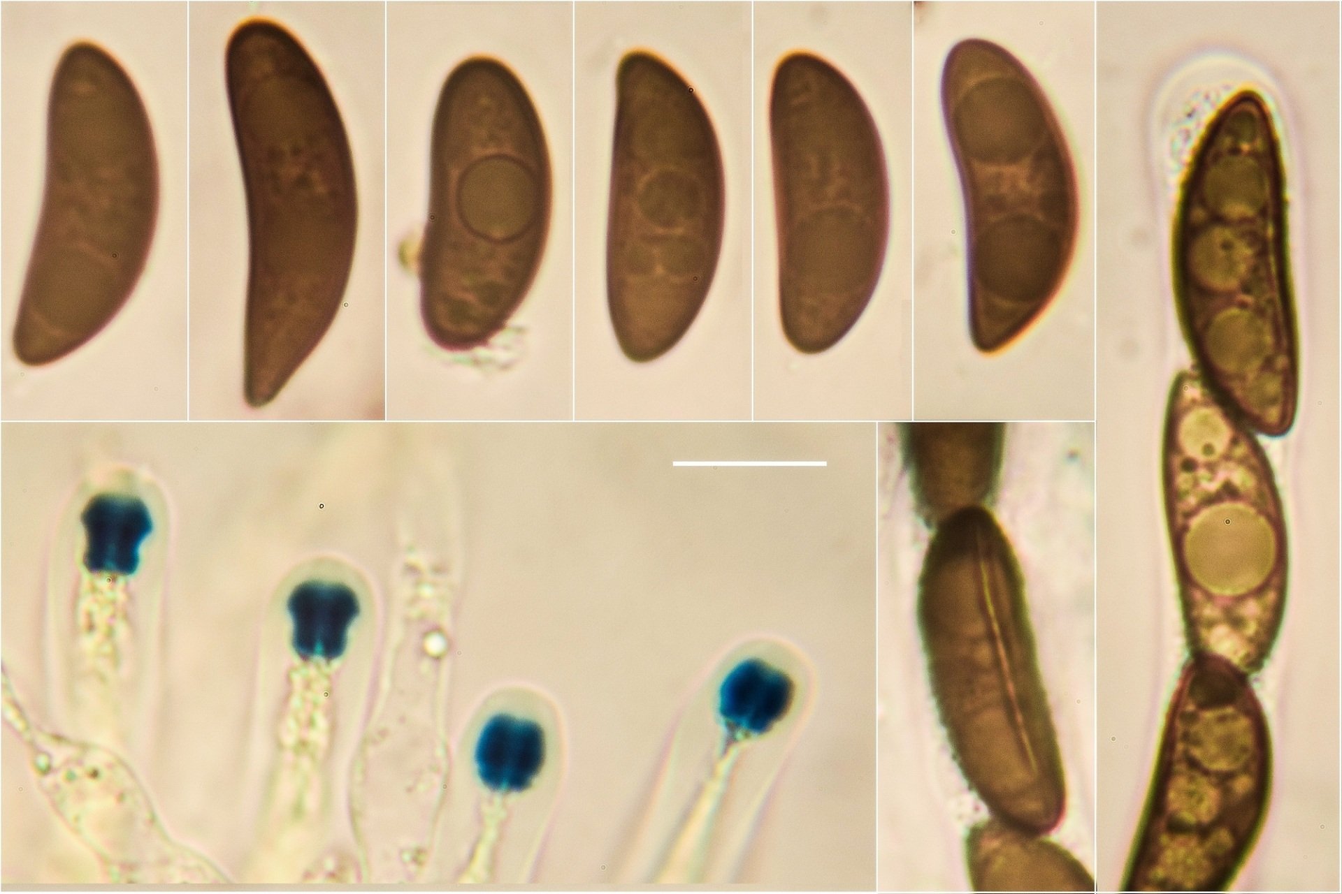 Astrocystis sublimbata