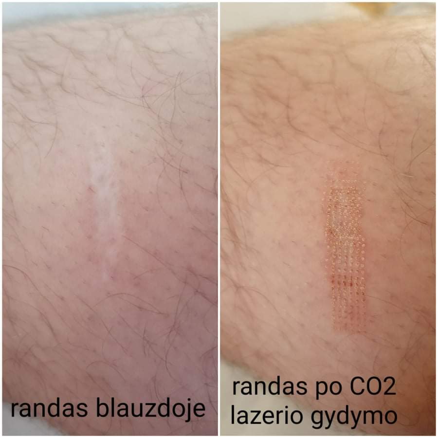 Odos procedūros Raseiniuose | Derma klinika