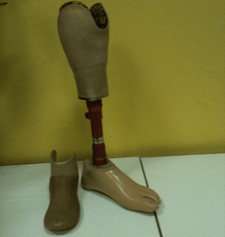 Protesi per amputati | Torino | Laboratorio Ortopedico Dimauro