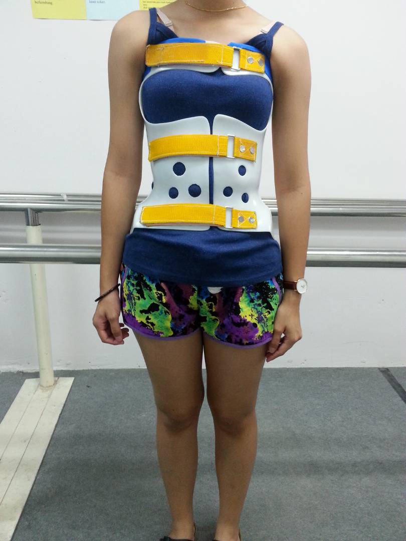 Custom-Made Orthotic | Total Medical Supplies Sdn Bhd - Prosthetic ...