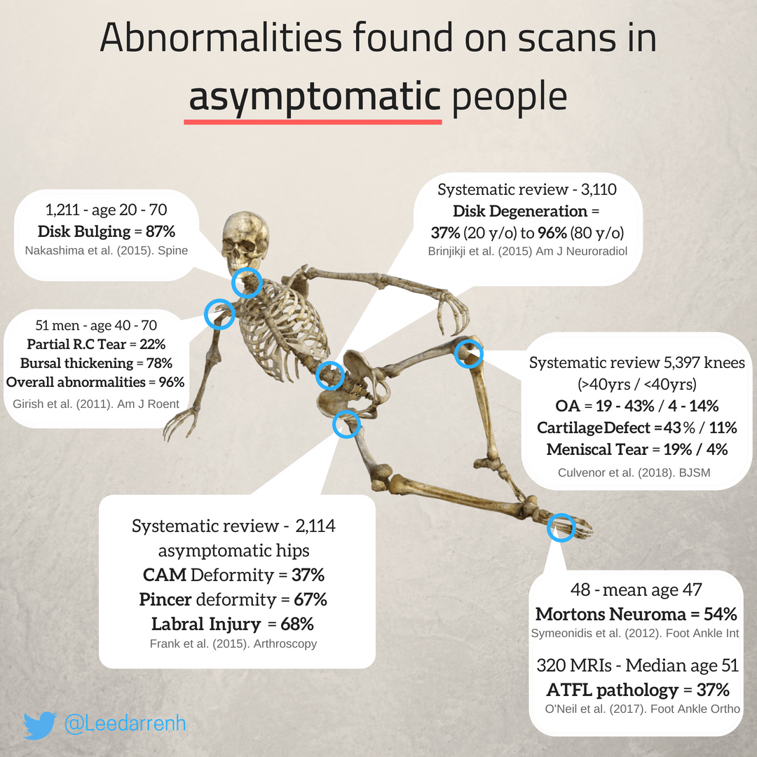 Physio In The Sticks Back Pain Back Injuries Sciatica Low Back Pain