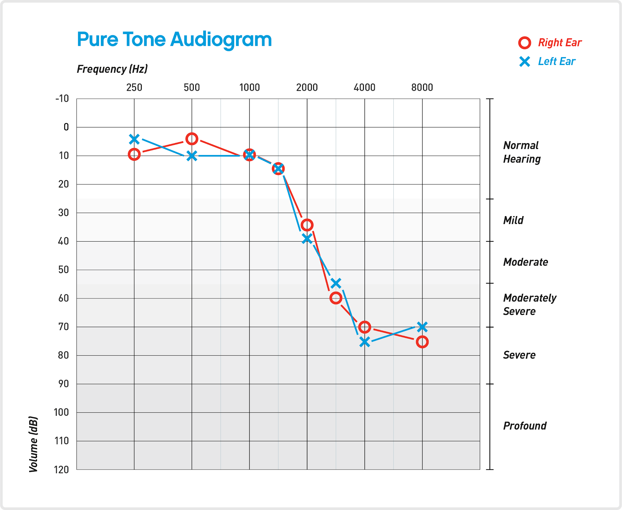 Understanding Your Audiogram