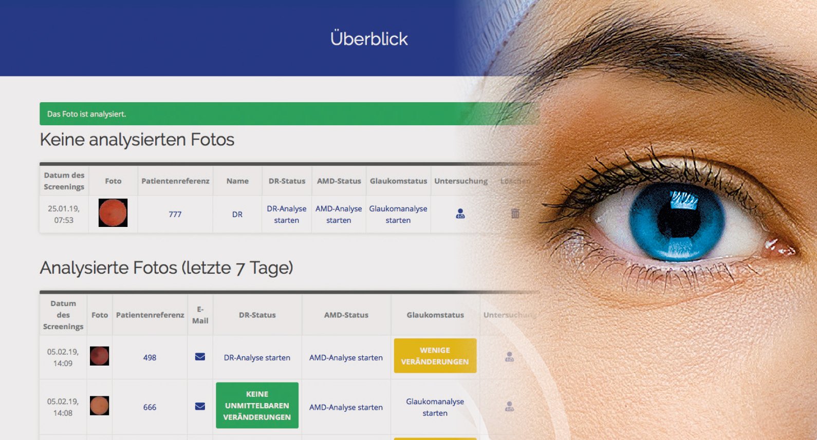 Reize Optik und RetinaLyze Schweiz geben neue strategische ...