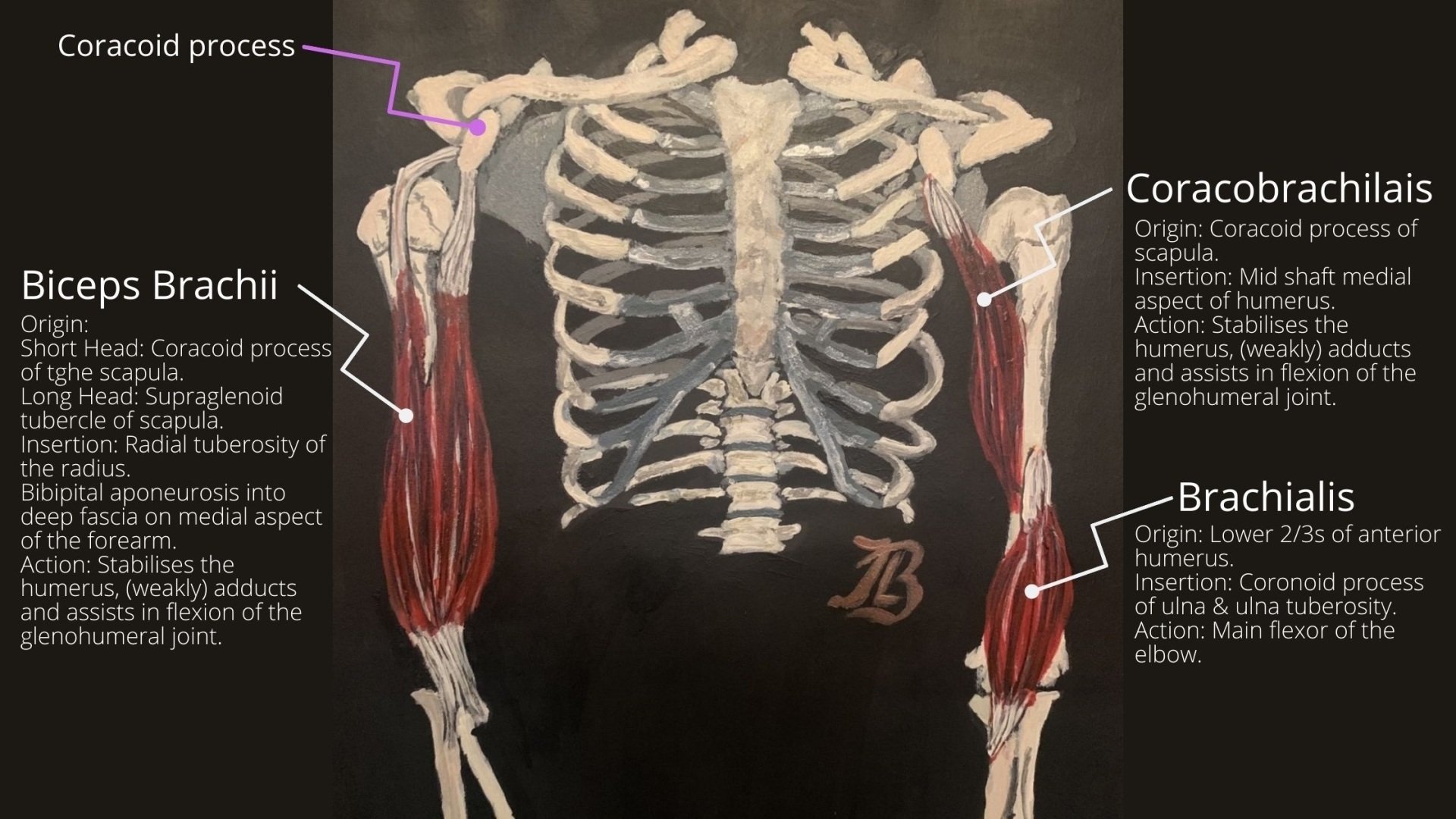 Osteopathy & Sports massage in Luton, Back Pain Clinic