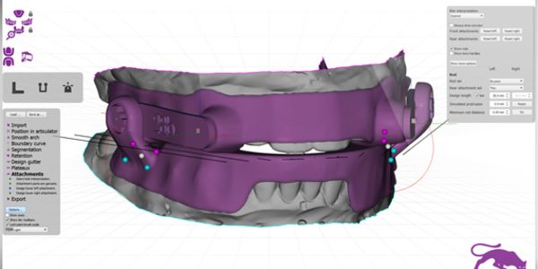 Oral Appliance Therapy - Sleep Apnea | Restore TMJ TX