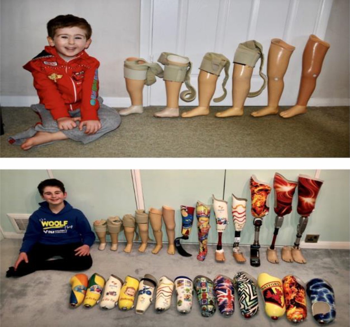 Gallery | Visibility for Disability