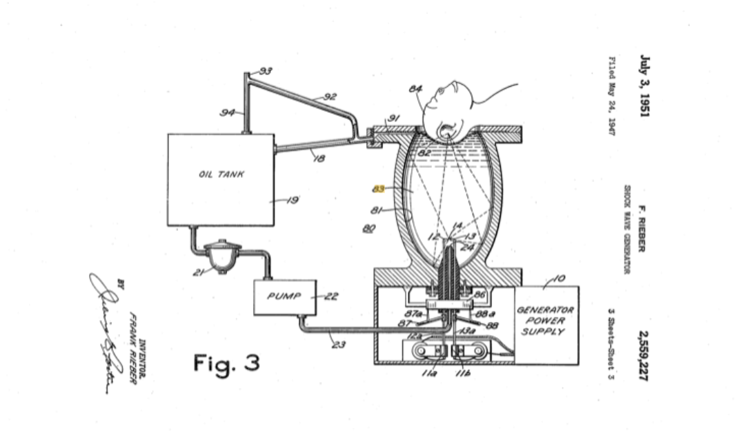 History of Extracorporeal Shockwave Therapy