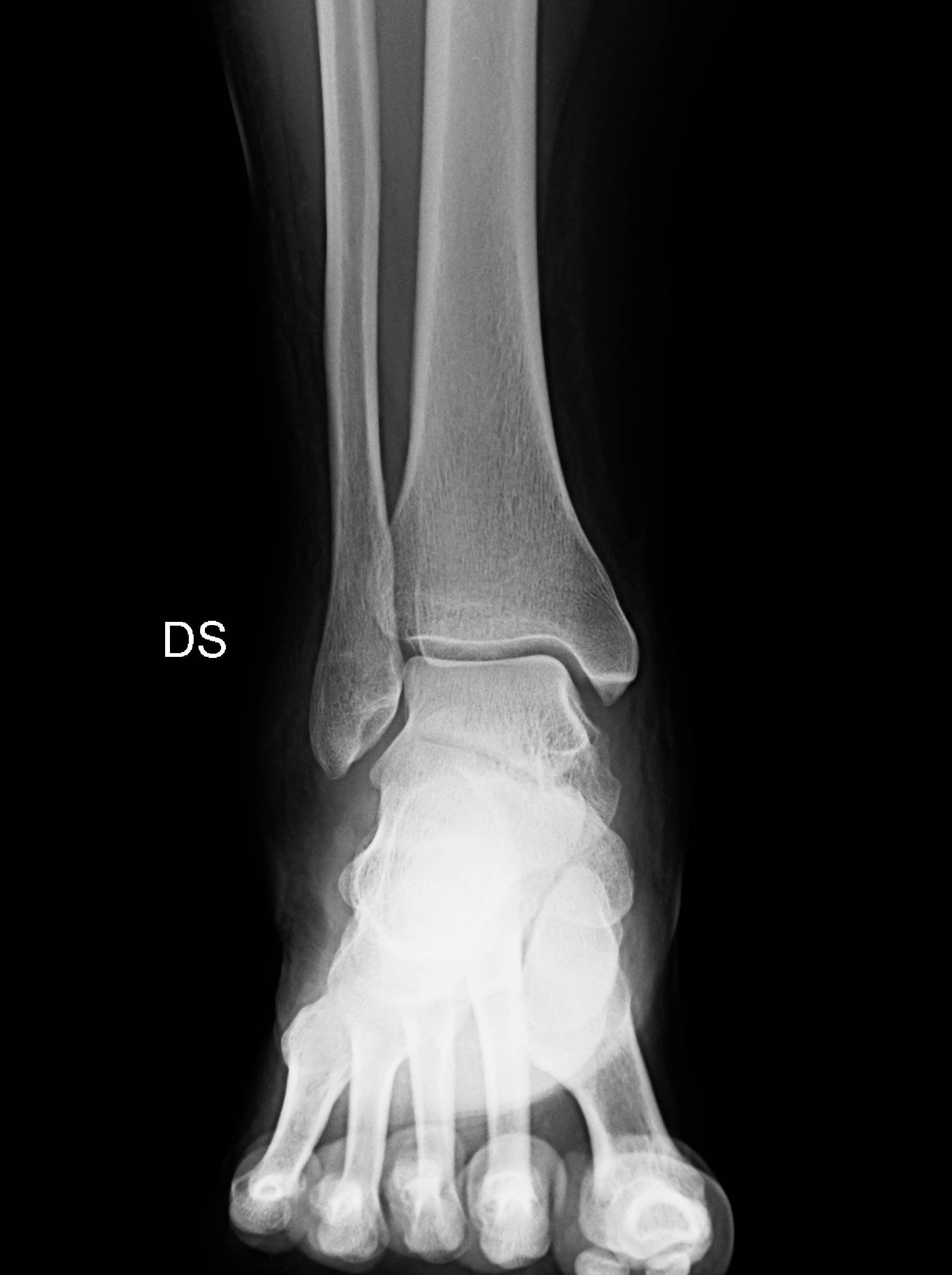 RX torace e addome | Rieti | RDC Erredicci Società Cooperativaa