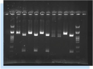 Syngene Gel Documentation e Imaging - Milano - Erreci