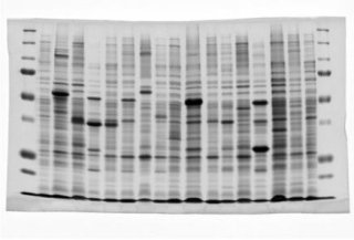 Syngene Gel Documentation e Imaging - Milano - Erreci