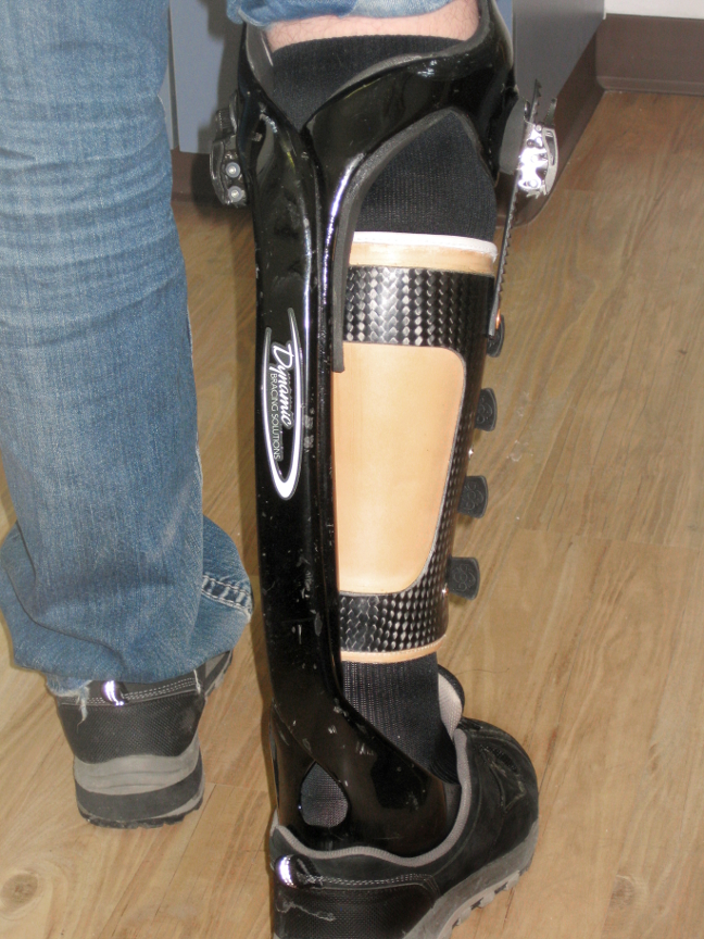 Custom Device Gallery - Northern Care, Inc., Prosthetics & Orthotics
