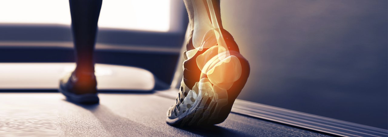 Gait analysis at Yorkshire Podiatry