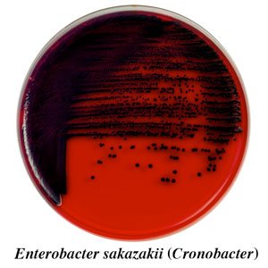 Enterobacter sakazakii Chromogenic Plating Medium