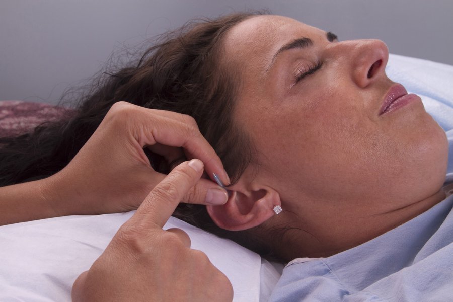 Acupuncture & Relaxation | Acupuncture Tradition - Traditional Chinese ...