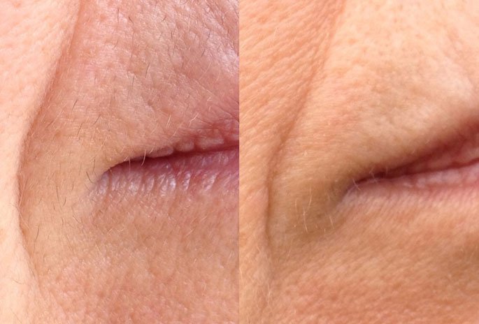 Skinade Targeted Solutions Clear | Acne Treatments Crosby | The ...