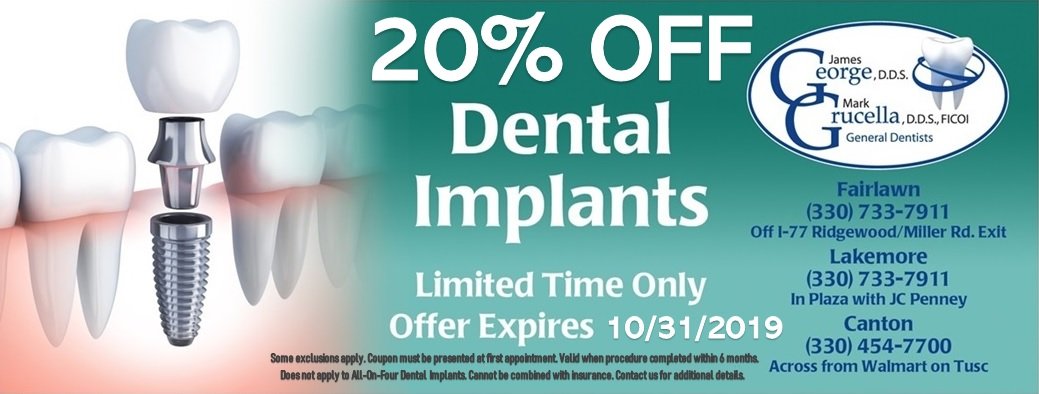 Dental Implants in Akron and Canton, Ohio